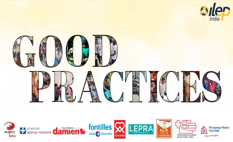 GOOD Practices - ILEP